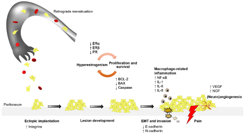 Pipeline - NETRIS PHARMA